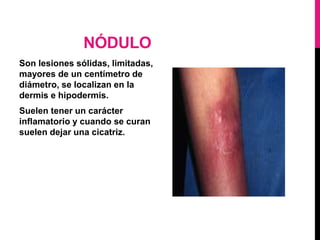 Exploracion de Piel y Anexos | PPTX