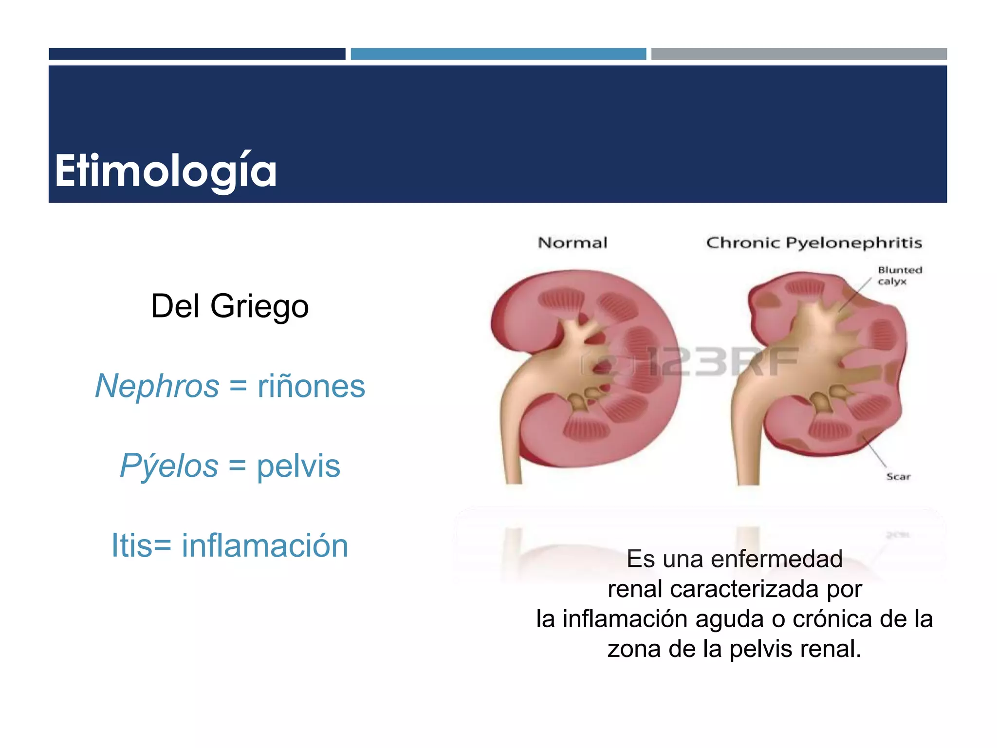 PIELONEFRITIS, ETIOLOGIA,FUNCIONES RENALES,EPIDEMIOLOGIA, ETIOLOGIA ...