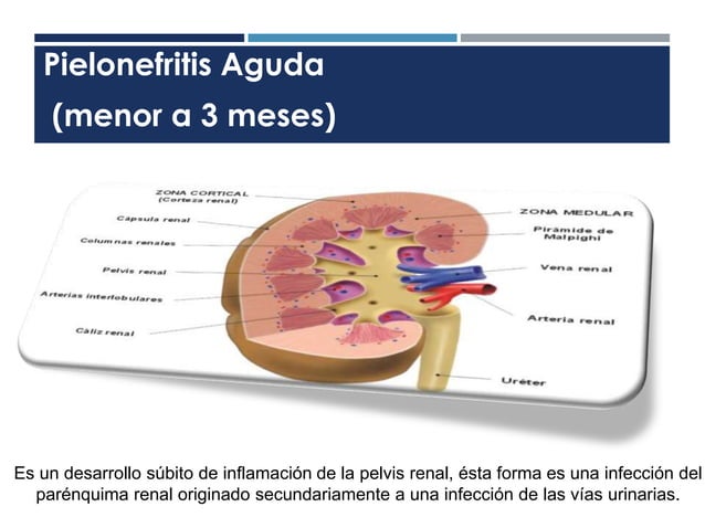 PIELONEFRITIS, ETIOLOGIA,FUNCIONES RENALES,EPIDEMIOLOGIA, ETIOLOGIA ...