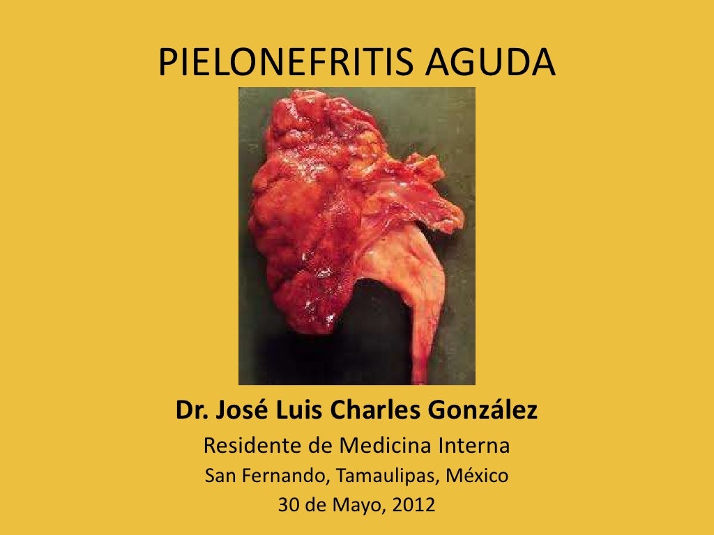 Pielonefritis aguda