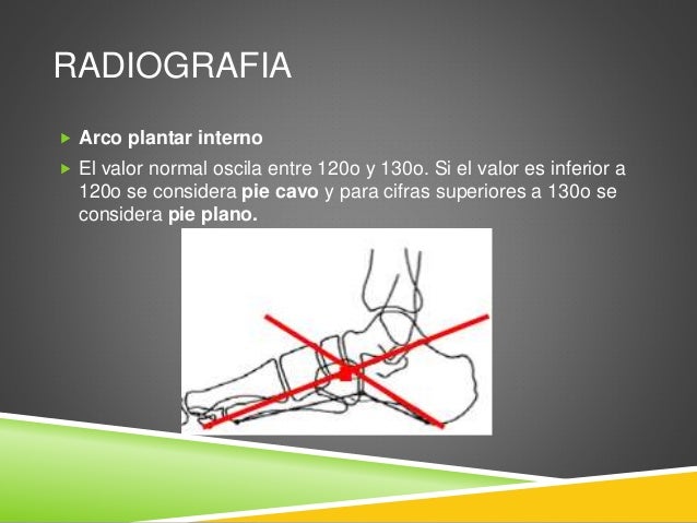 Pie plano