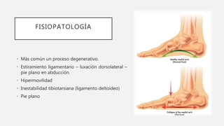 Pie plano del adulto.pptx