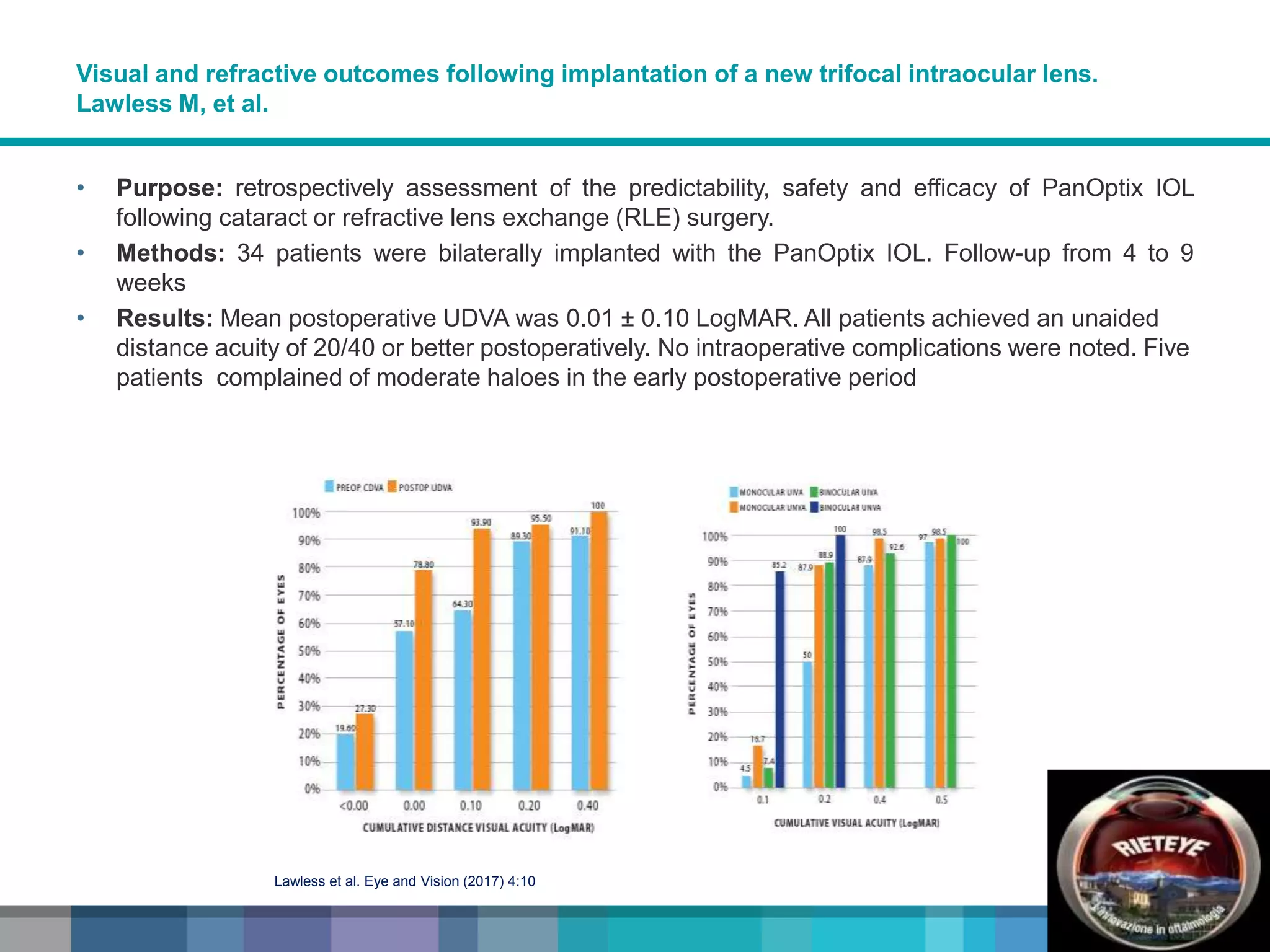 Nuovo IOL TRIFOCALE: caratteristiche tecniche | PPT