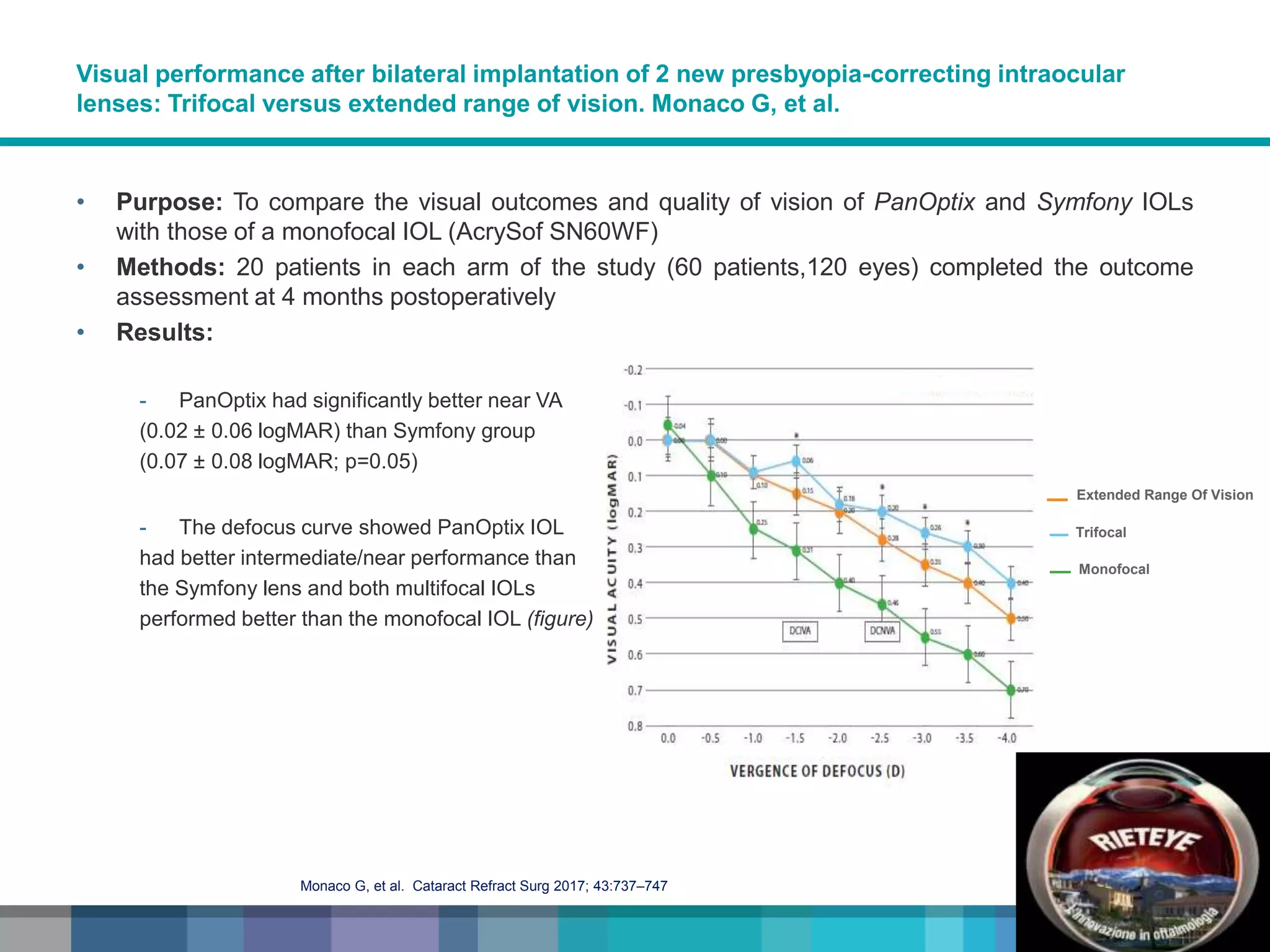 Nuovo IOL TRIFOCALE: caratteristiche tecniche | PPT