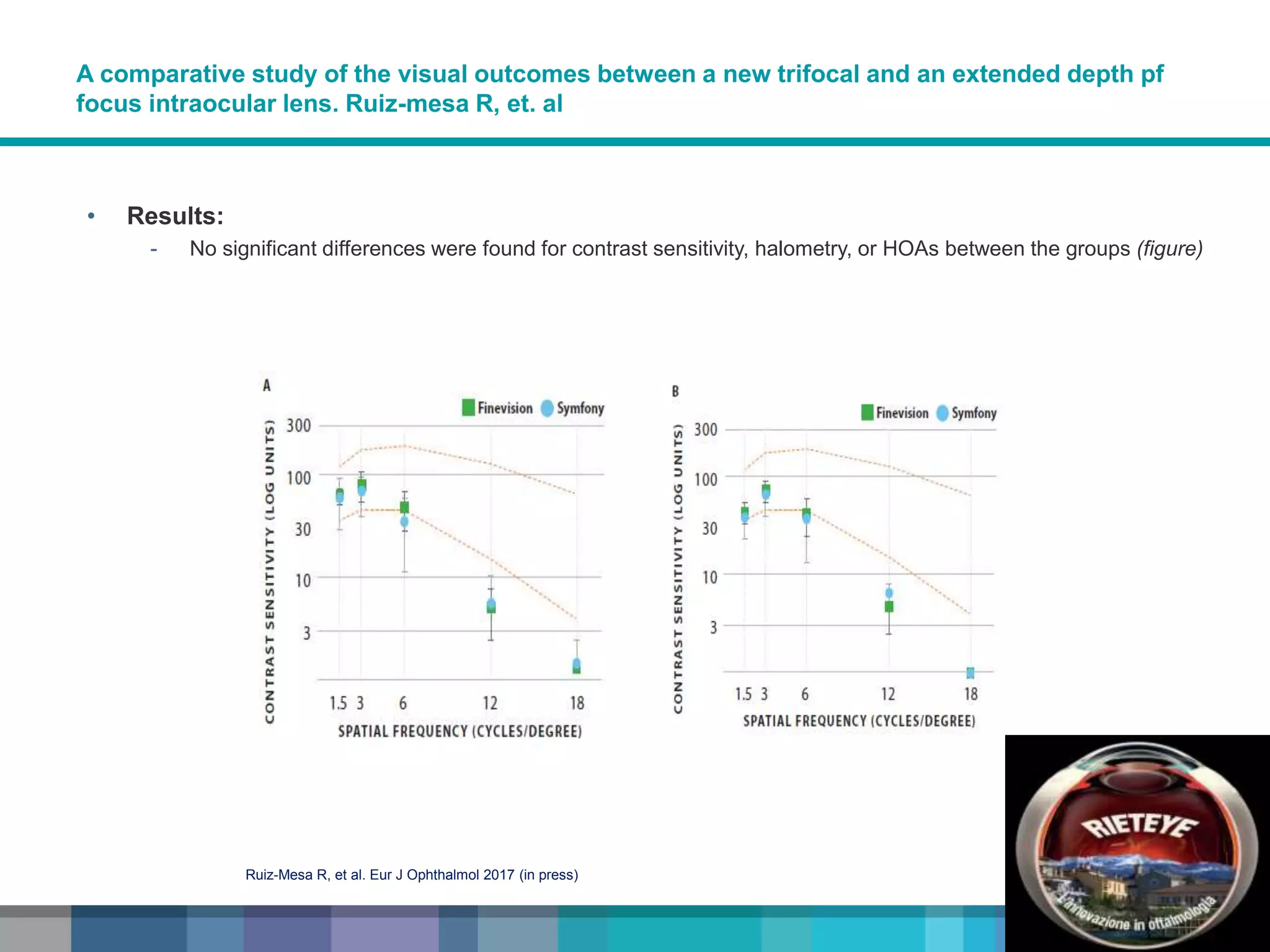Nuovo IOL TRIFOCALE: caratteristiche tecniche | PPT