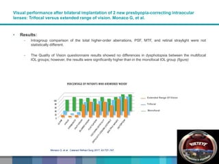 Nuovo IOL TRIFOCALE: caratteristiche tecniche | PPT