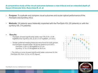 Nuovo IOL TRIFOCALE: caratteristiche tecniche | PPT