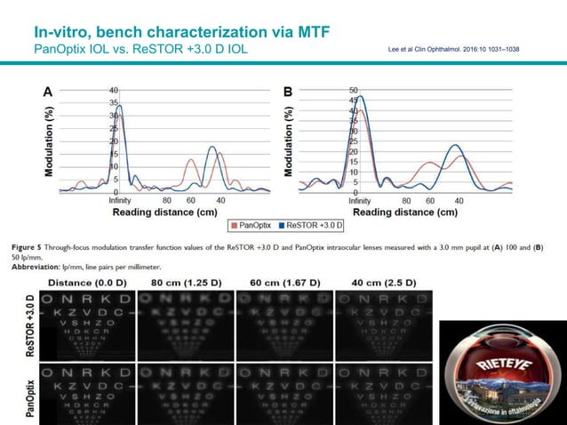 Nuovo IOL TRIFOCALE: caratteristiche tecniche | PPT