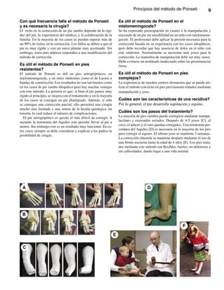 Pie zambo el_mã©todo_ponseti | PDF