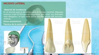 piezas dentales y el instrumental correcto para su exodoncia ADULTOS.pptx