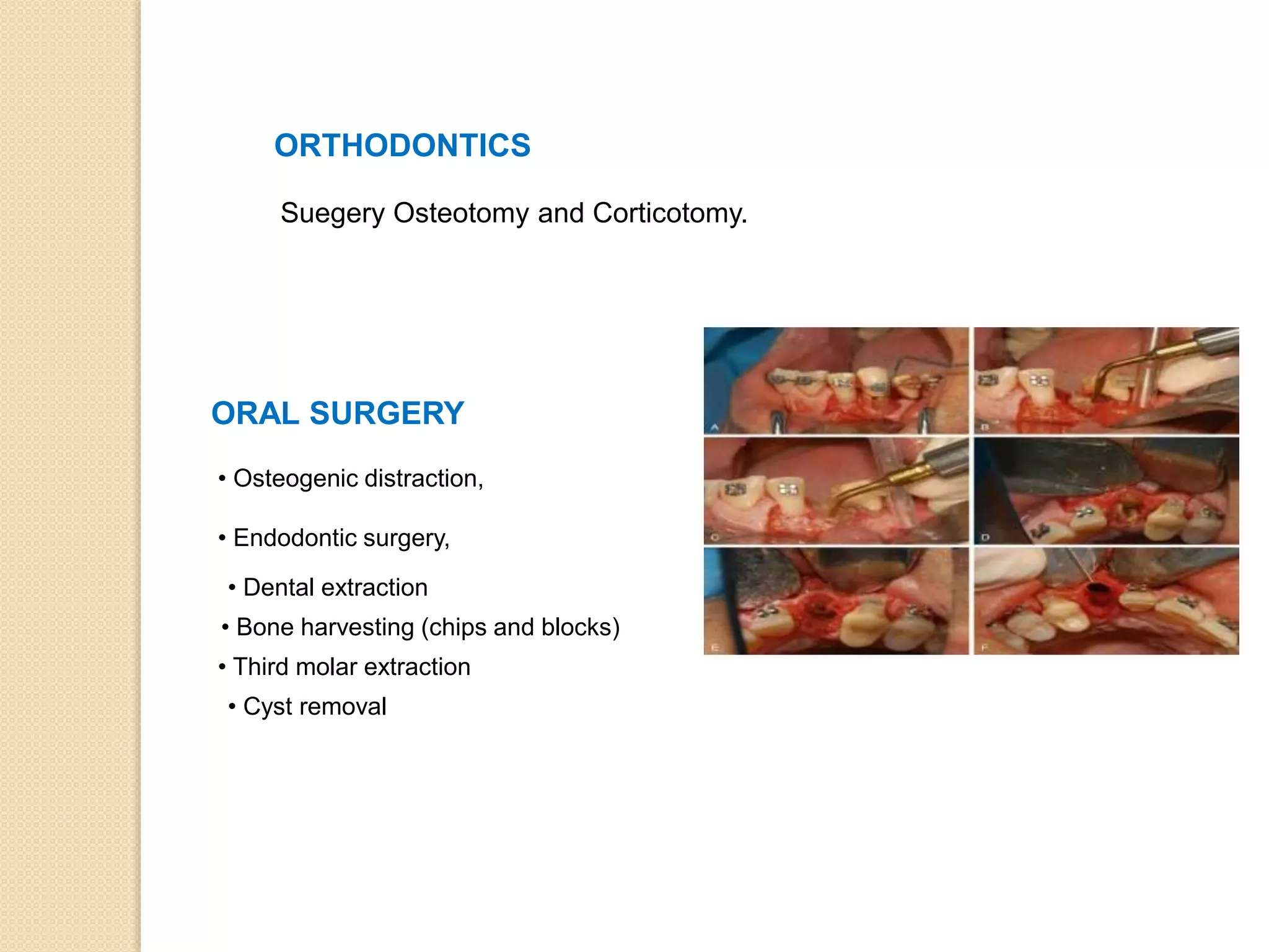 PIEZOELECTRIC SURGERY- | PPTX