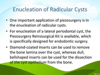Piezoelectric surgery in endodontics | PPTX