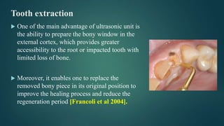 Piezoelectric surgery in periodontics | PPTX