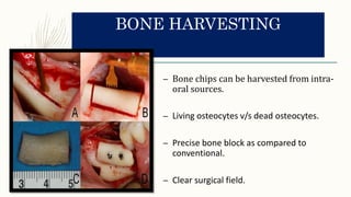 Piezosurgery | PPTX