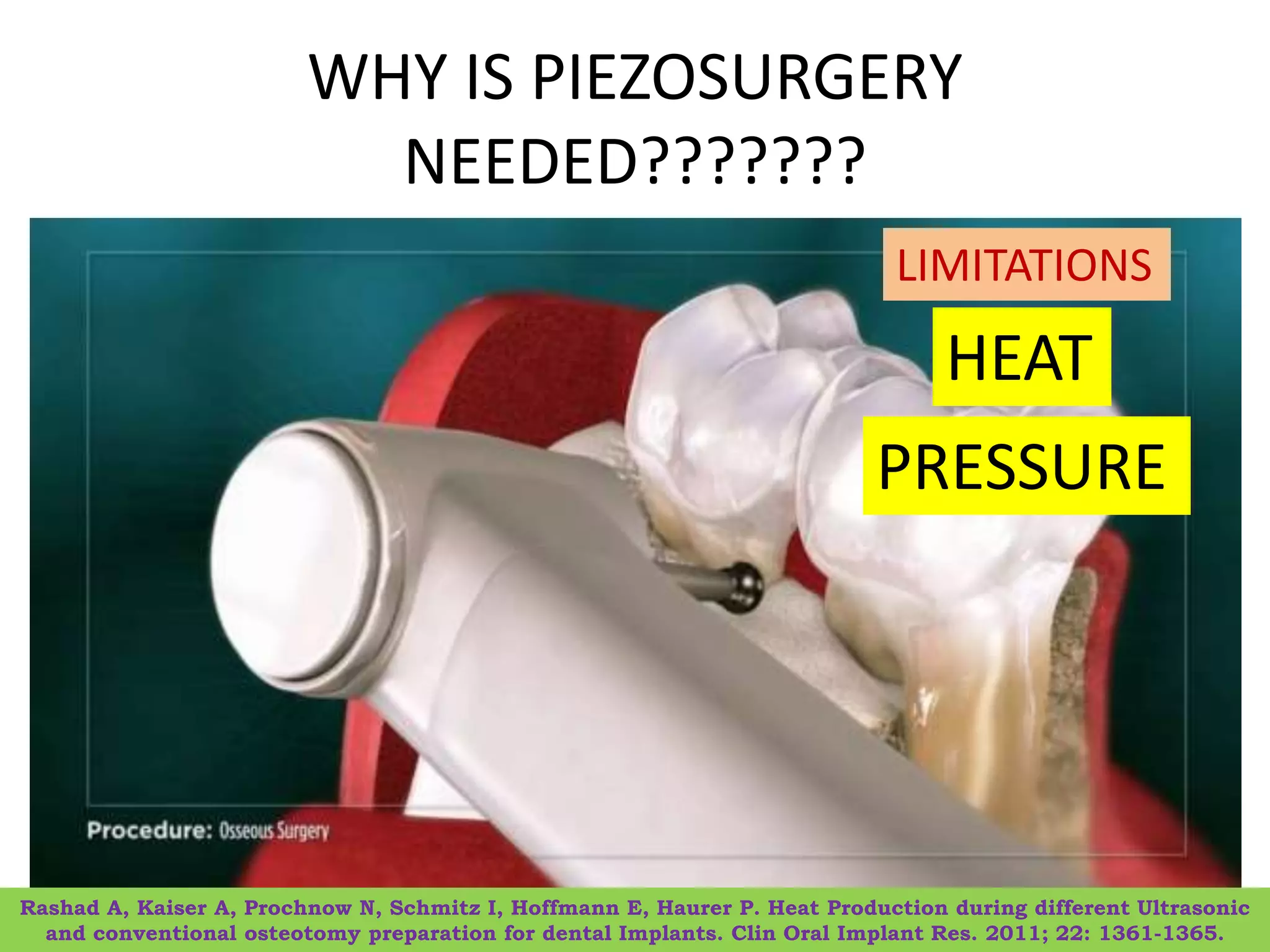 Piezosurgery in periodontics | PPTX
