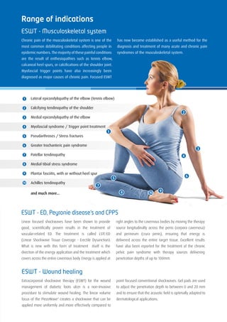 Piezowave 2 general brochure | PDF