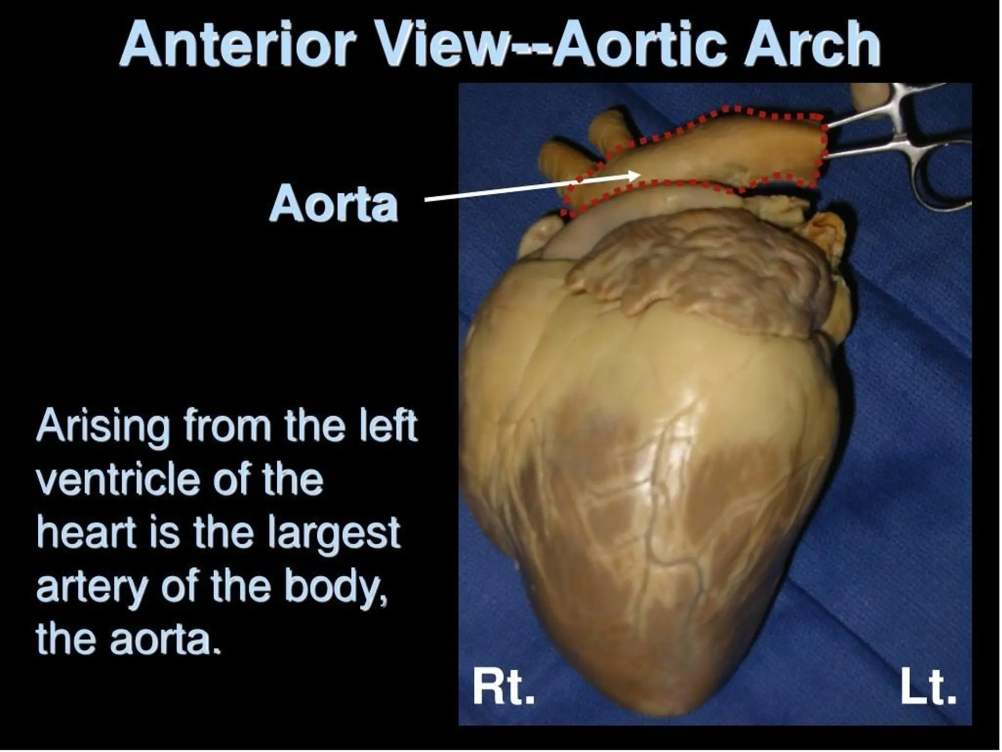 Pig Heart Dissection Heart 2025 Edit.pptx