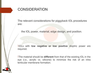 Piggyback iol | PPT