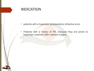 Piggyback iol | PPT
