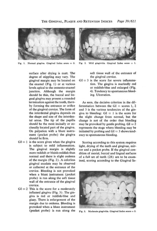 Pi,gi Loe and Sliness : ORIGINAL ARTICLE | PDF