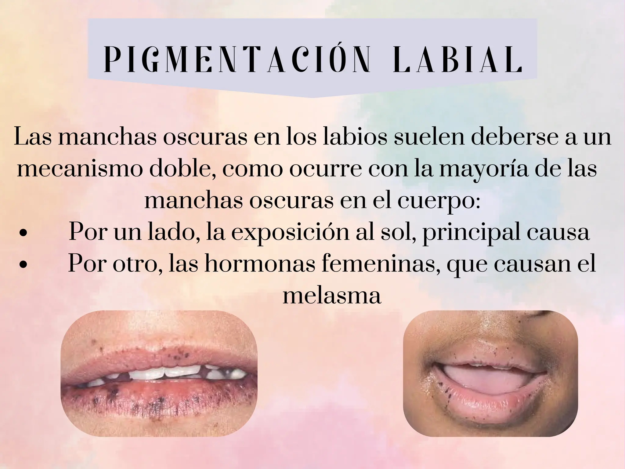 Pigmentación dental y labial (1).pdf