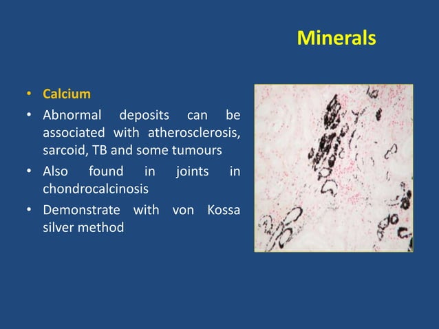 PIGMENT AND MINERALS.pptx | Skin and Dermatology | Diseases and Conditions