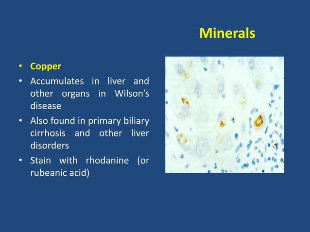 PIGMENT AND MINERALS.pptx | Skin and Dermatology | Diseases and Conditions