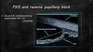 Pigmentary glaucoma - Dr Shylesh B Dabke | PPTX