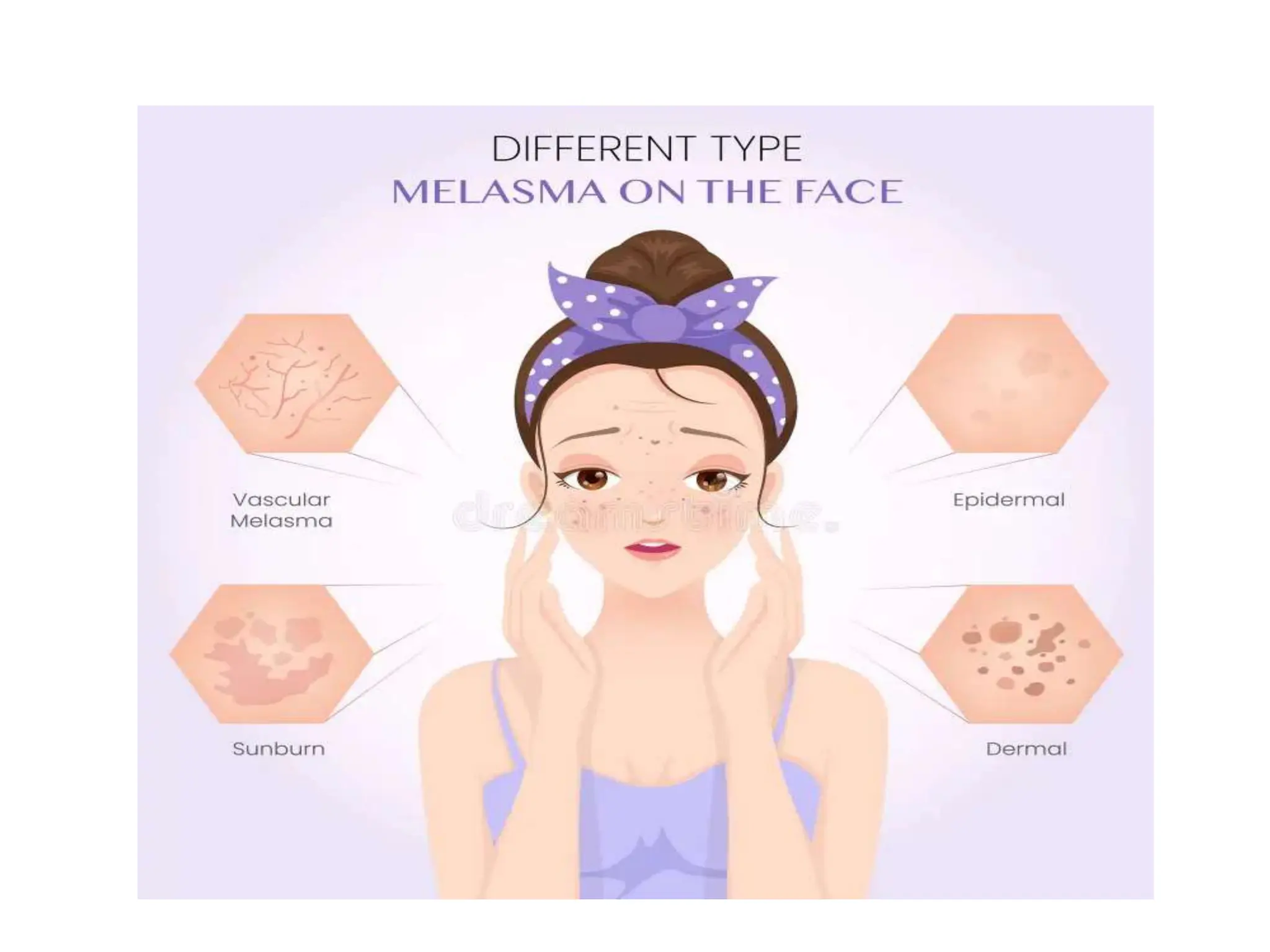 Skin Pigmentation disorders and its management .pptx