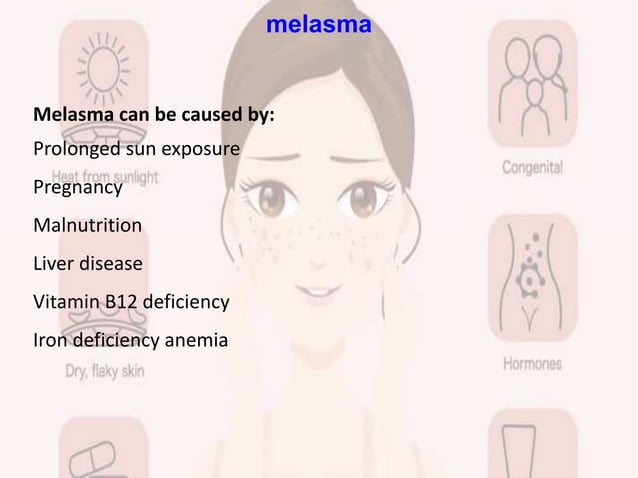 Skin Pigmentation disorders and its management .pptx