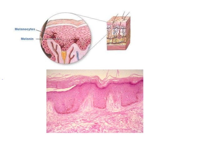Skin Pigmentation disorders and its management .pptx