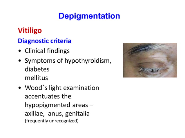 Skin Pigmentation disorders and its management .pptx