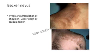 Pigmentation disorders of skin dermatology revision notes | PDF