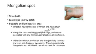 Pigmentation disorders of skin dermatology revision notes | PDF