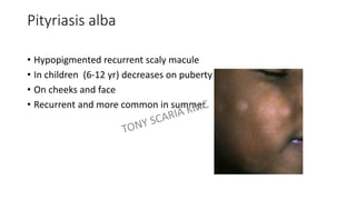Pigmentation disorders of skin dermatology revision notes | PDF