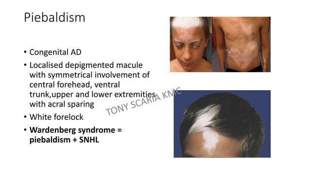Pigmentation disorders of skin dermatology revision notes | PDF | Skin ...