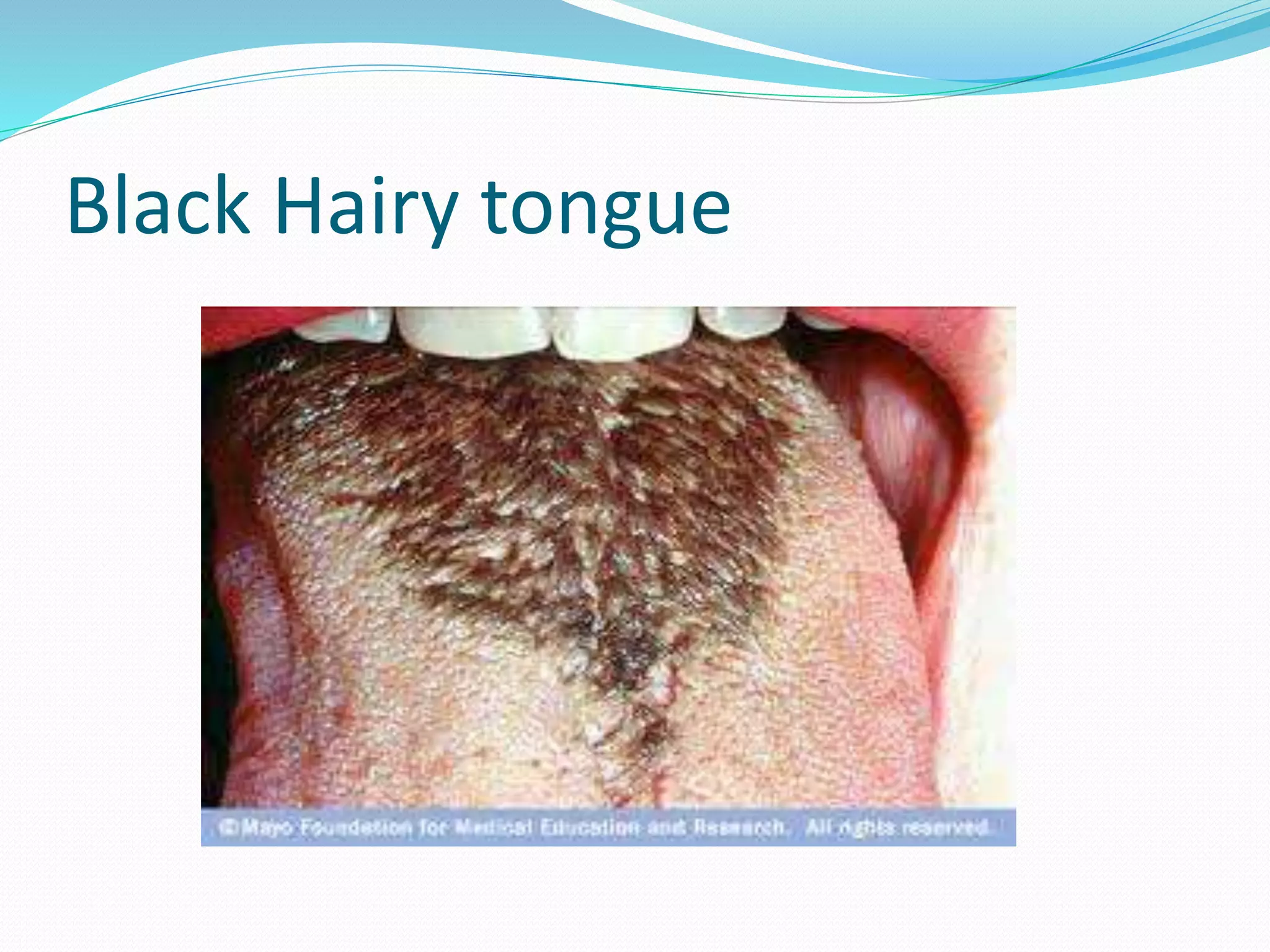 oral Pigmentations | PPTX