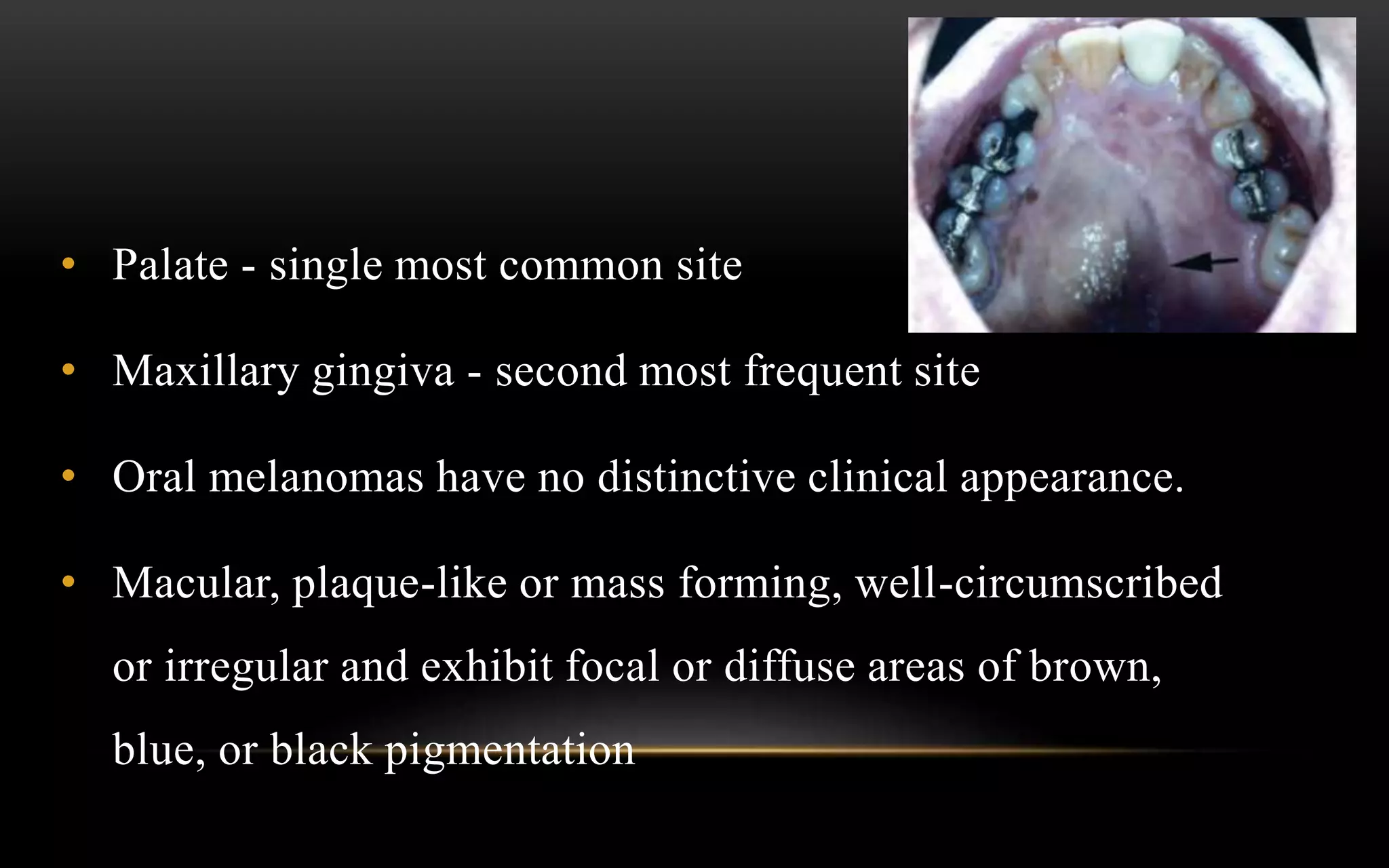 Pigmentations of the oral cavity | PPTX