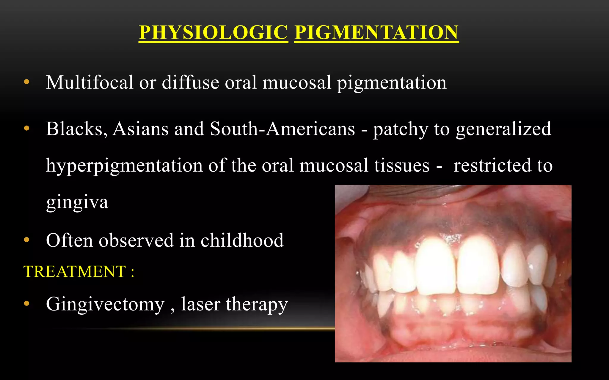 Pigmentations of the oral cavity | PPTX