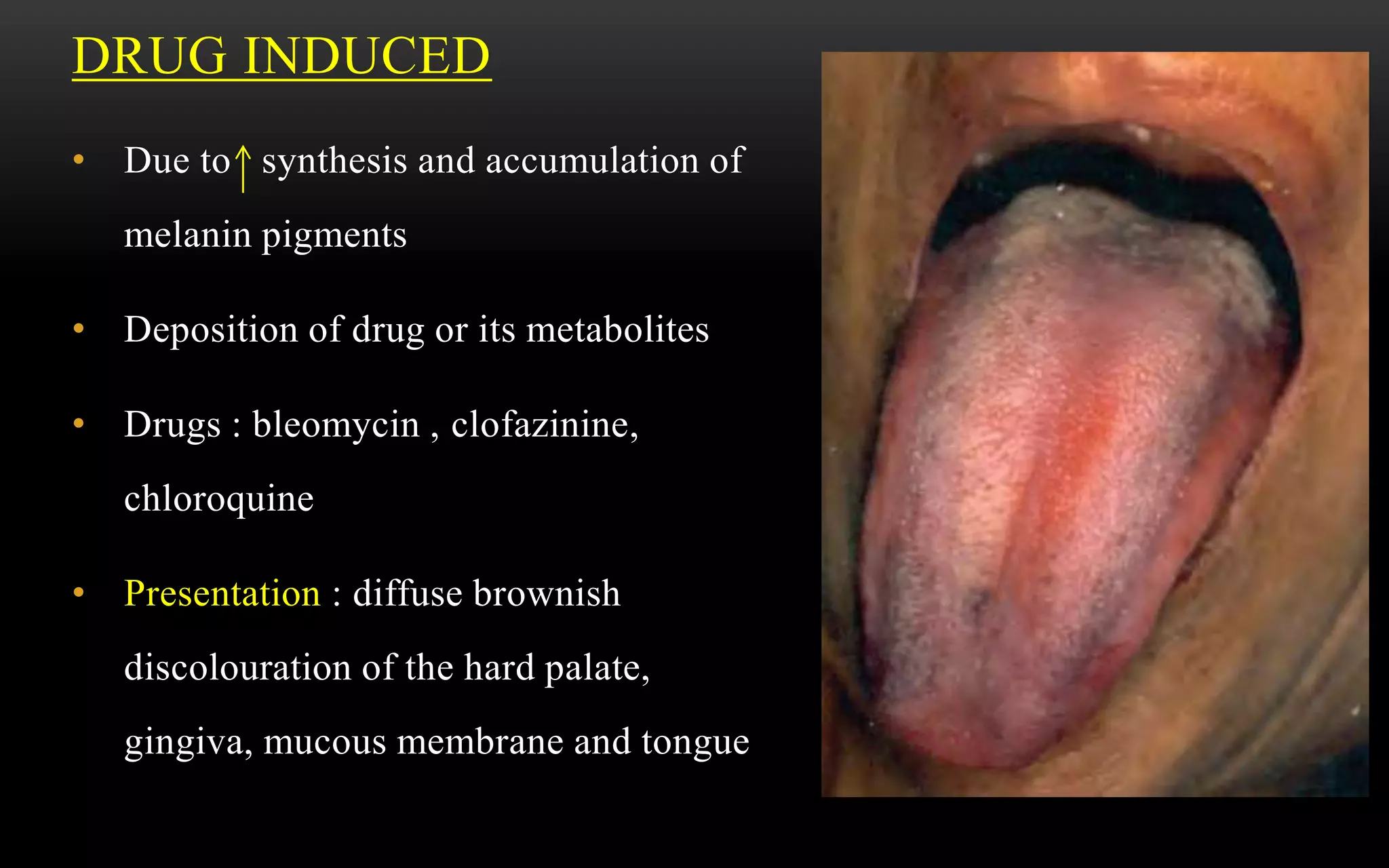 Pigmentations of the oral cavity | PPTX