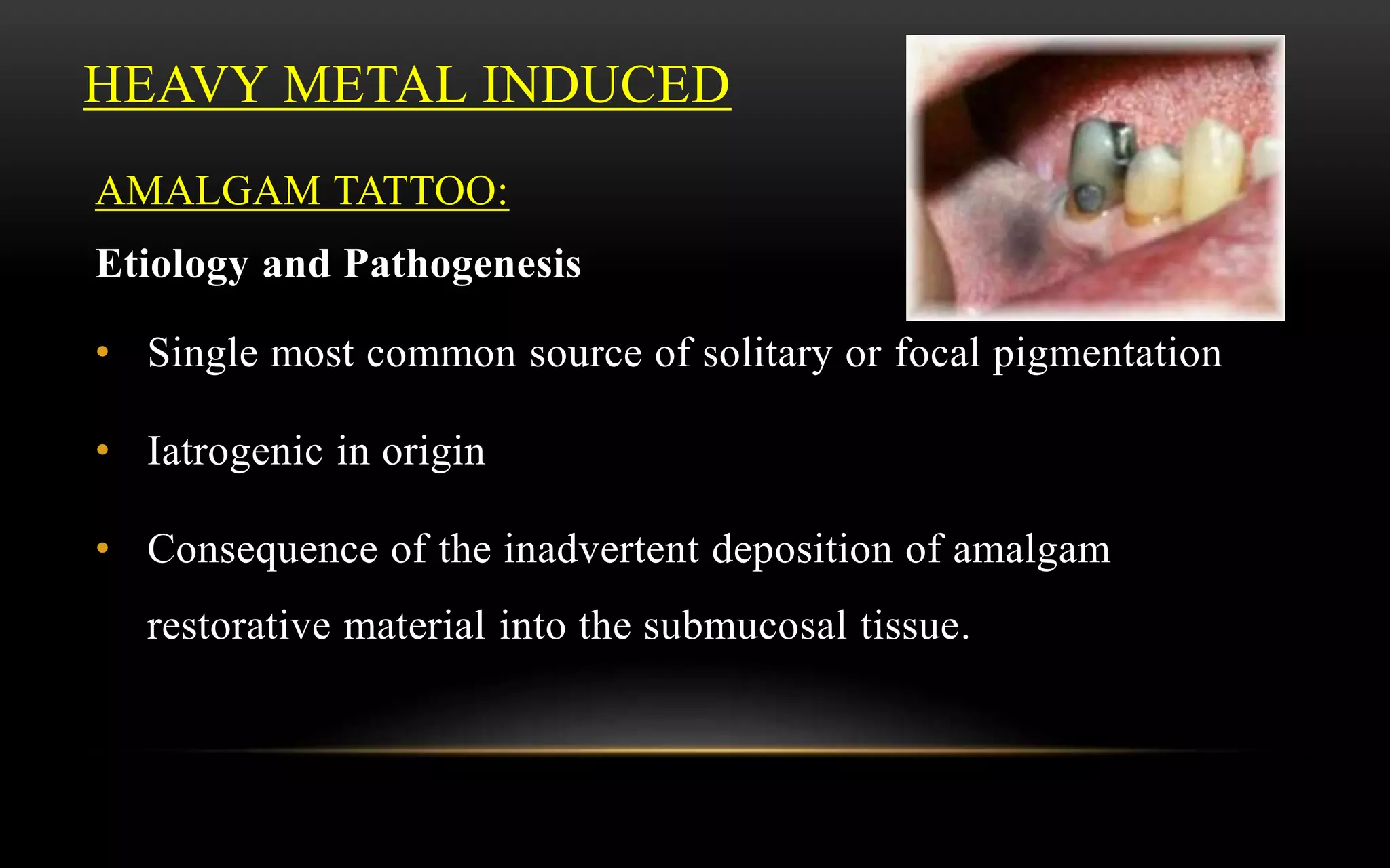 Pigmentations of the oral cavity | PPTX