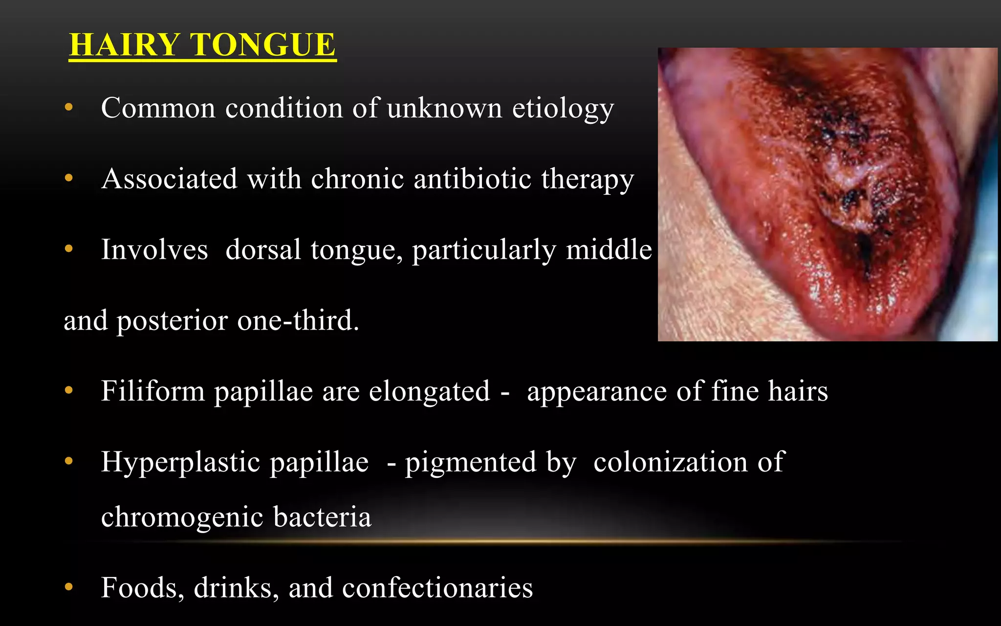 Pigmentations of the oral cavity | PPTX