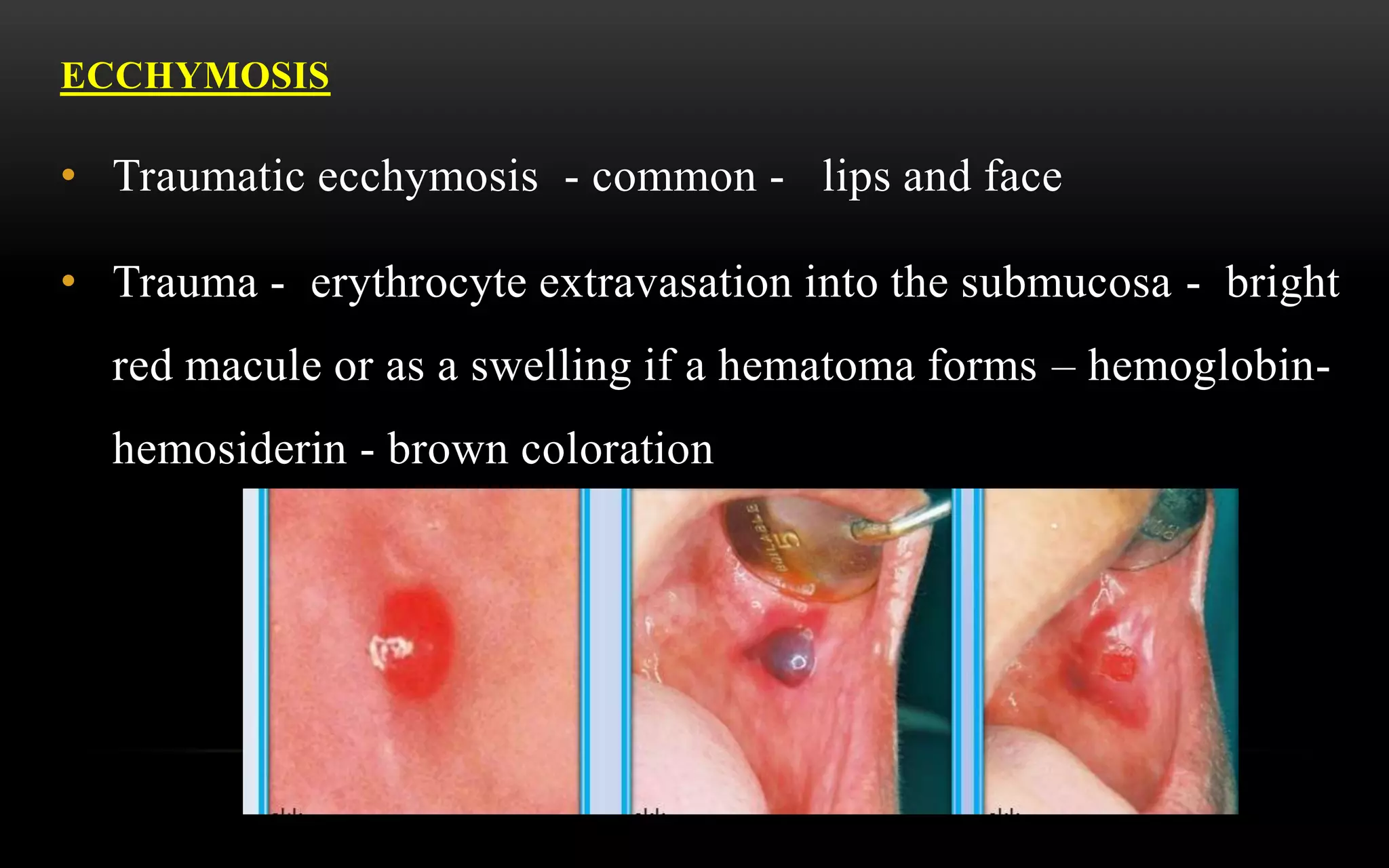 Pigmentations of the oral cavity | PPTX