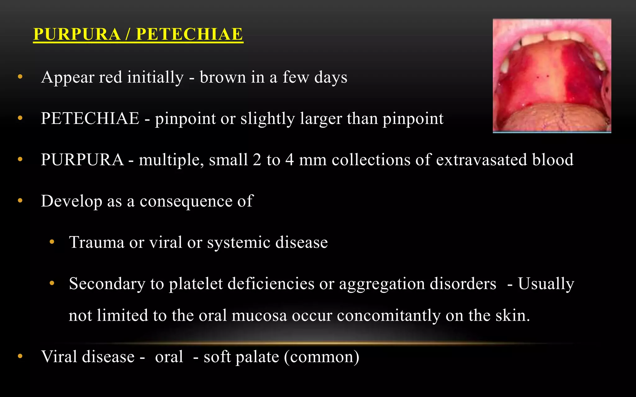 Pigmentations of the oral cavity | PPTX