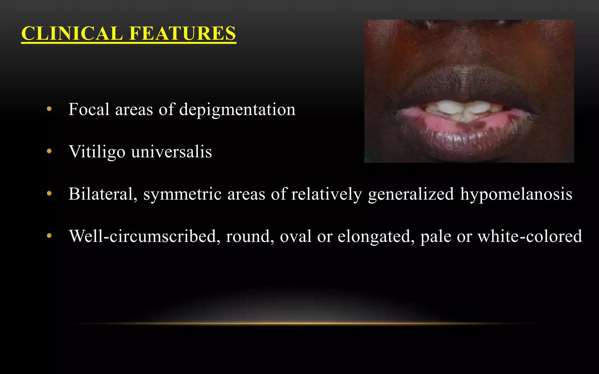 Pigmentations of the oral cavity | PPTX
