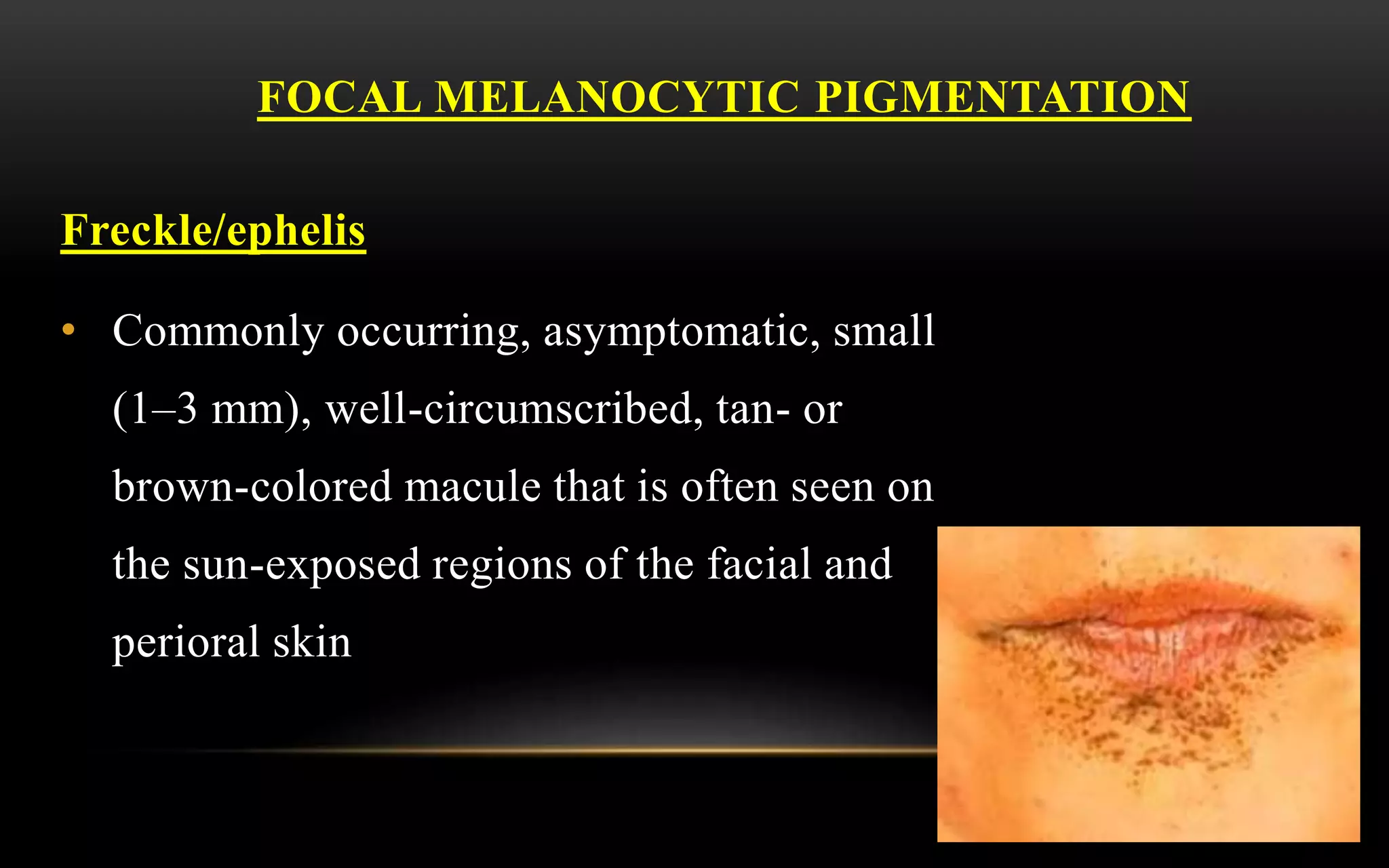 Pigmentations of the oral cavity | PPTX
