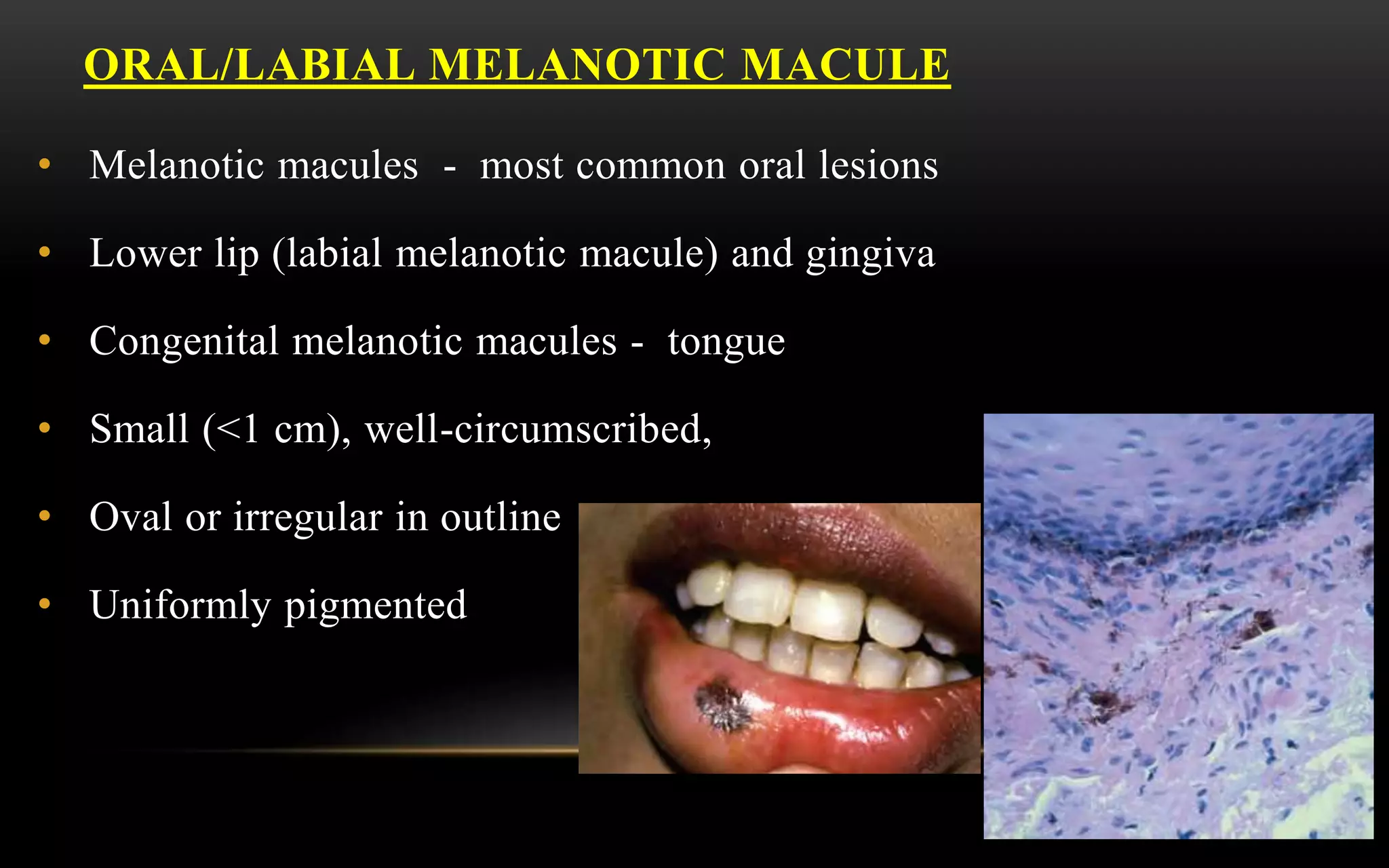 Pigmentations of the oral cavity | PPTX