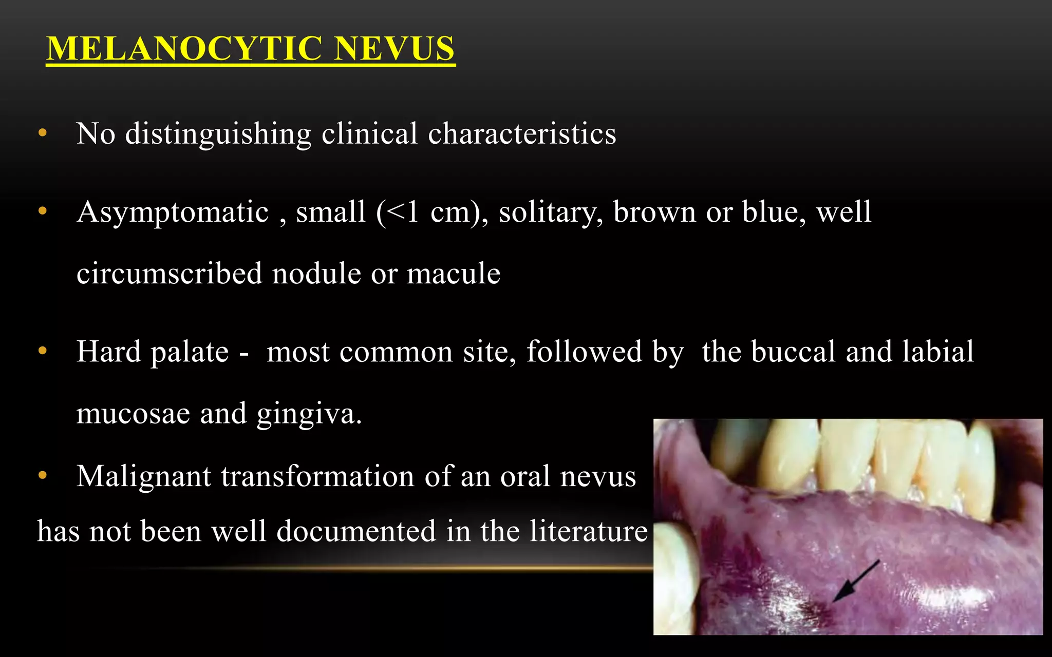 Pigmentations of the oral cavity | PPTX