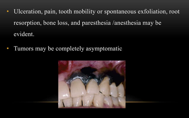 Pigmentations of the oral cavity | PPTX