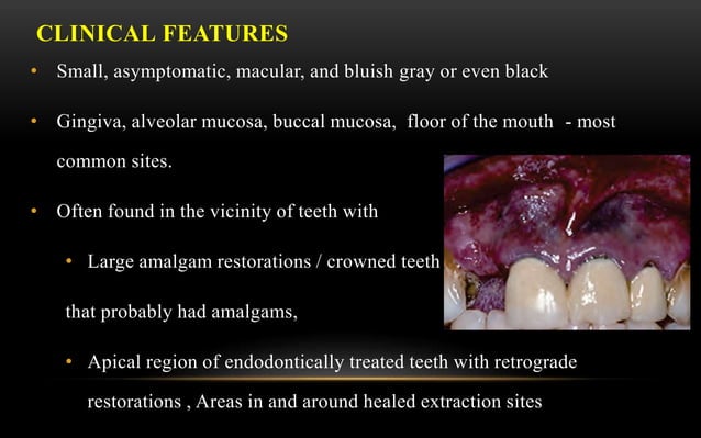 Pigmentations of the oral cavity | PPTX